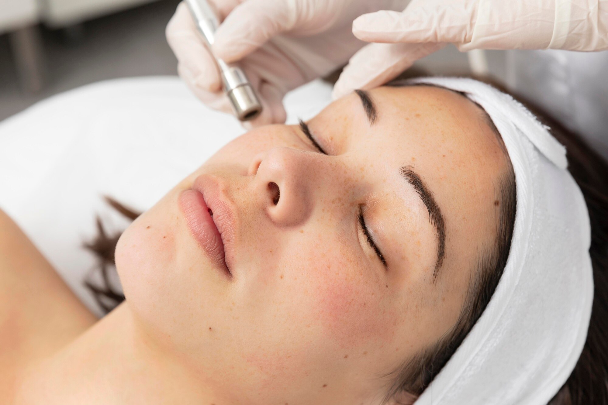 Everything You Need to Know About Microdermabrasion from a Medical ...